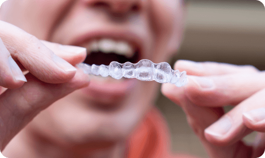 Invisalign Clear Aligners - Mona Vale Dental